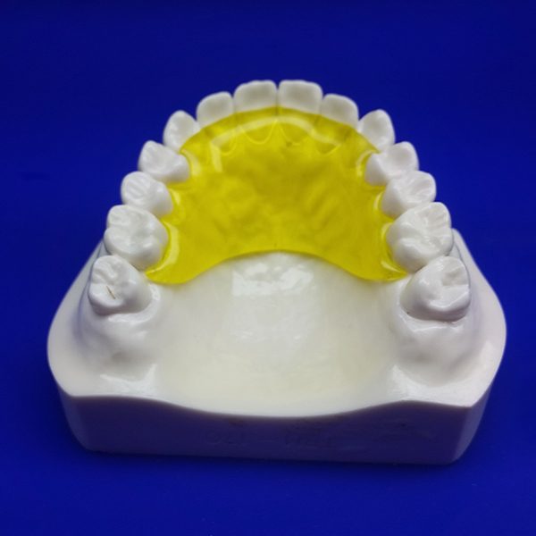 Hawley Retainer – iHome Dental