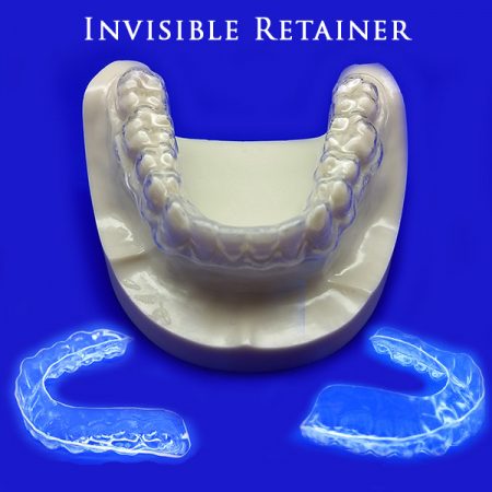 Invisible Retainer Step 1 - iHome Dental